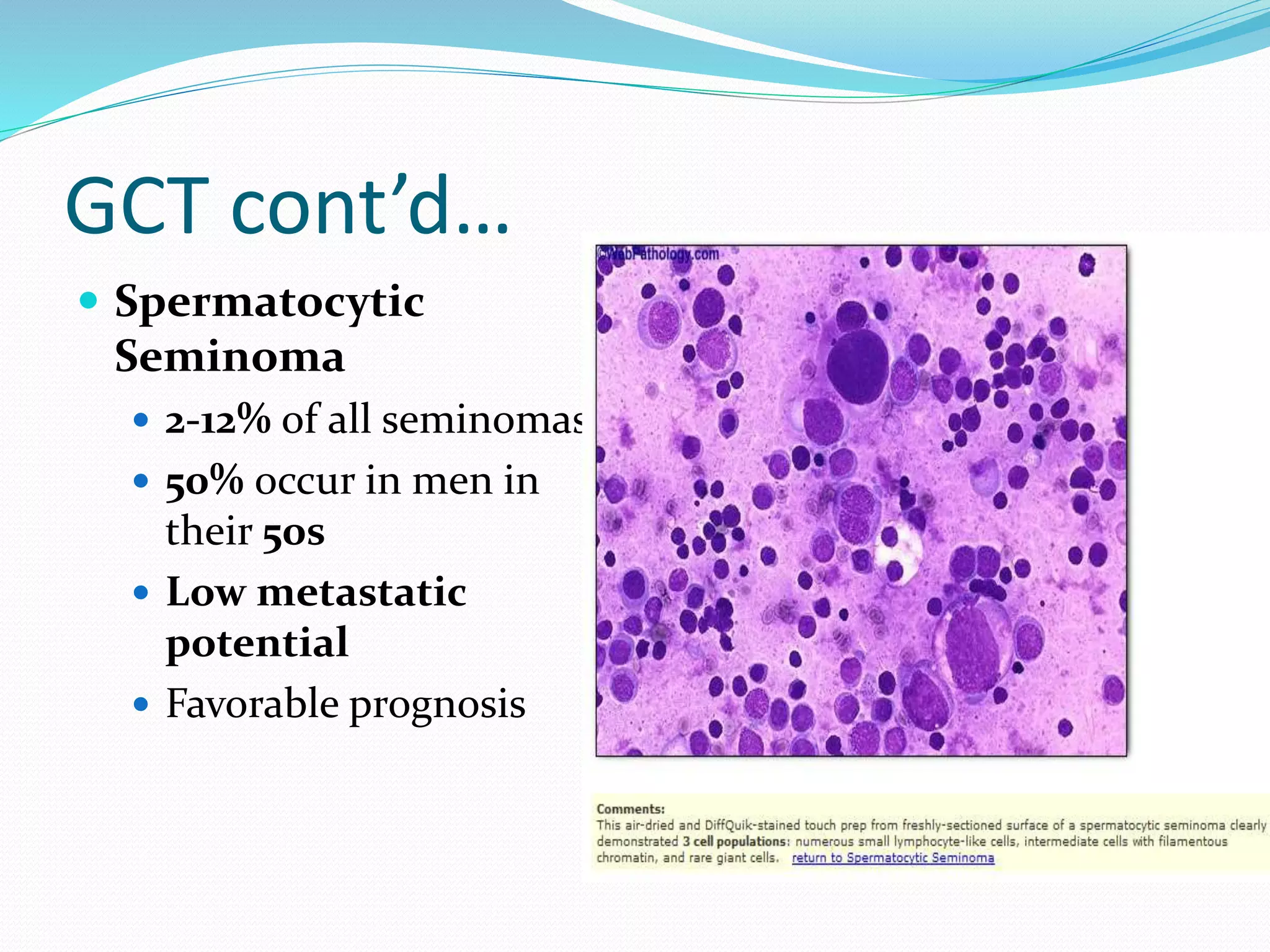 Pathology of testicular tumors | PPTX