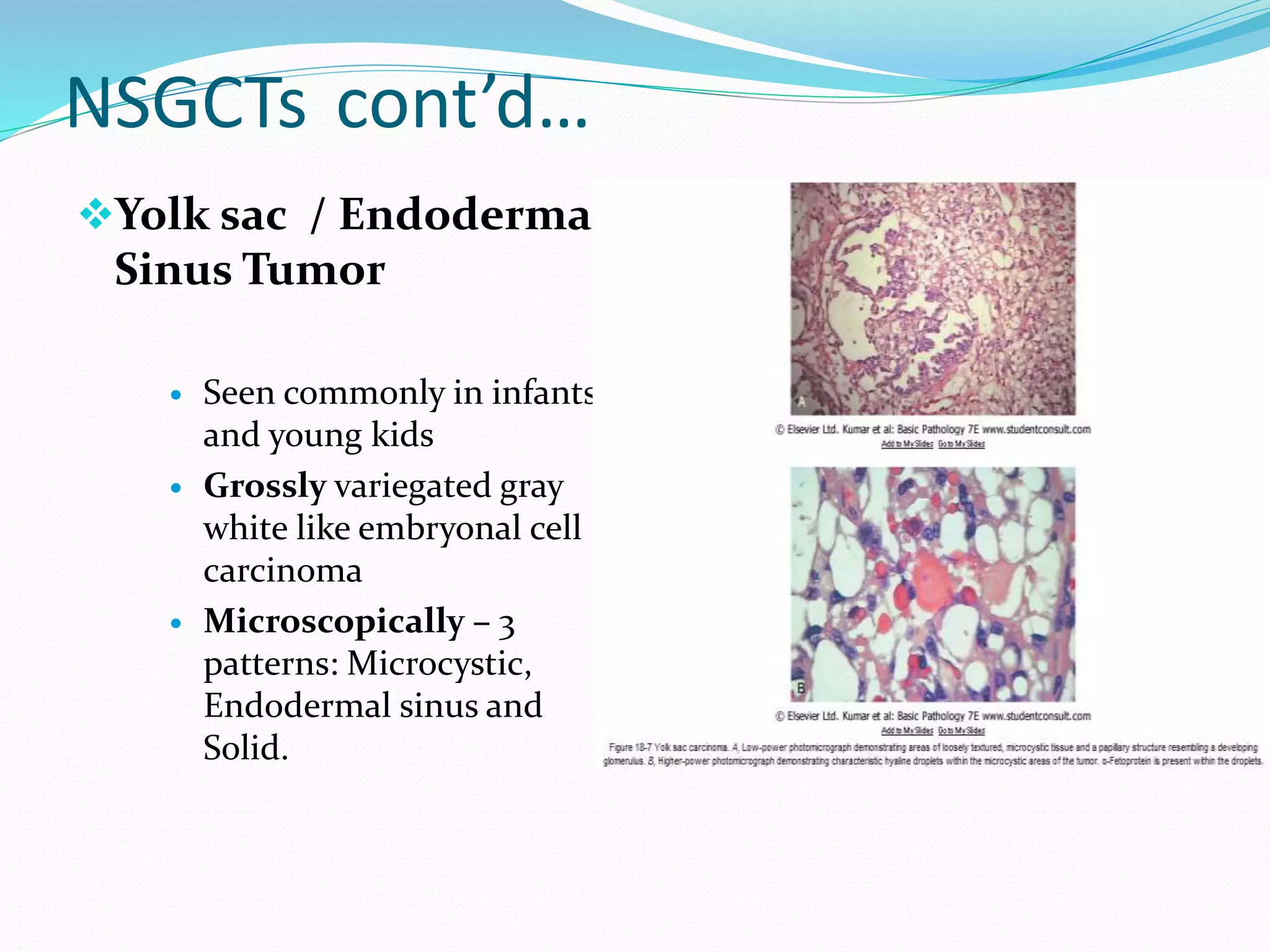 Pathology of testicular tumors | PPTX