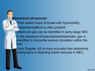 Necrotizing Enterocolitis | PPTX