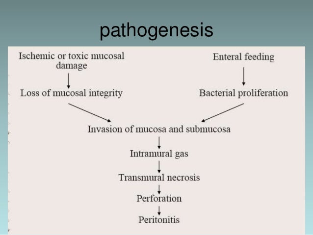 Necrotizing Enterocolitis