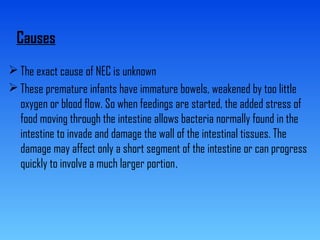 Necrotizing enterocolitis | PPT