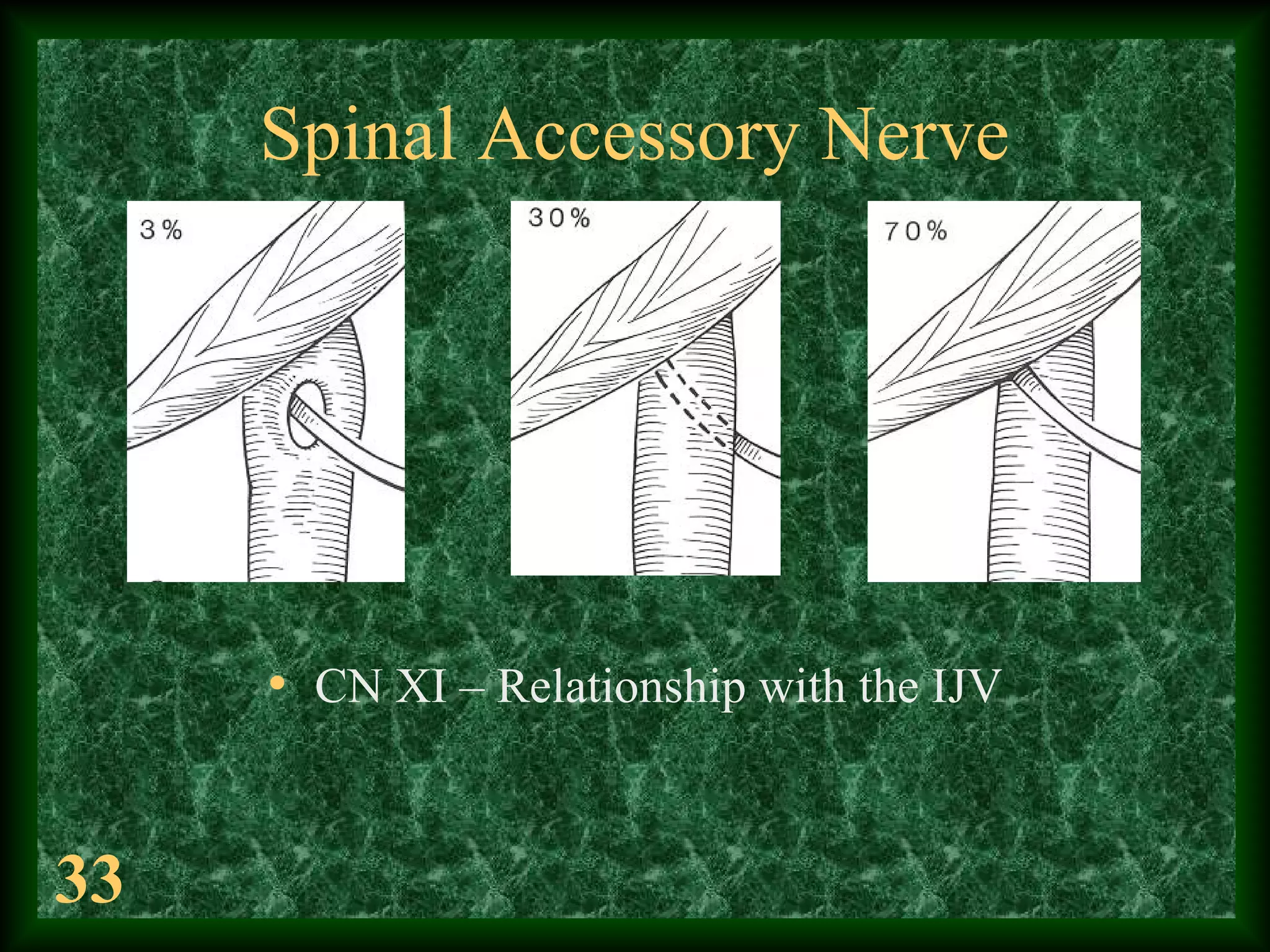 Neck dissection-020116-slides | PPT