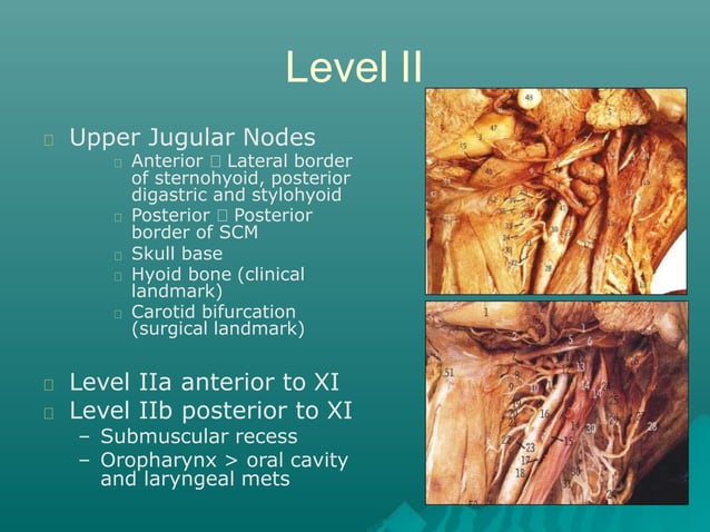 Neck Dissection | PPT