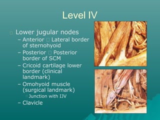 Neck Dissection | PPTX