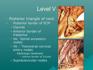 Neck Dissection | PPTX