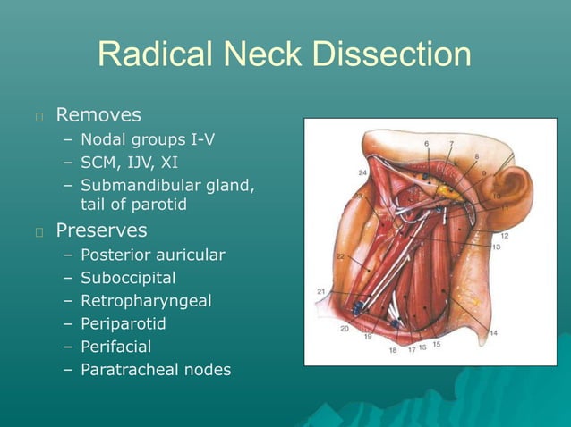 Neck Dissection | PPT