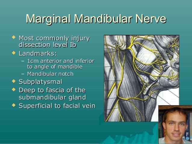 Neck dissection-slides-060920