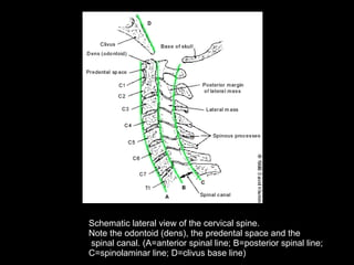 Neck Pain After Trauma | PPT
