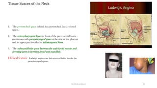 NECK anatomy muscles with clinical anatomy.pdf
