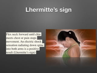 Neck and back pain | PDF