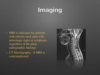 Neck and back pain | PDF