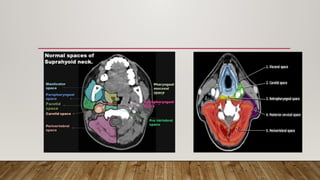 NECK AND ELBOW CT PROTOCOLS group 10.pptx