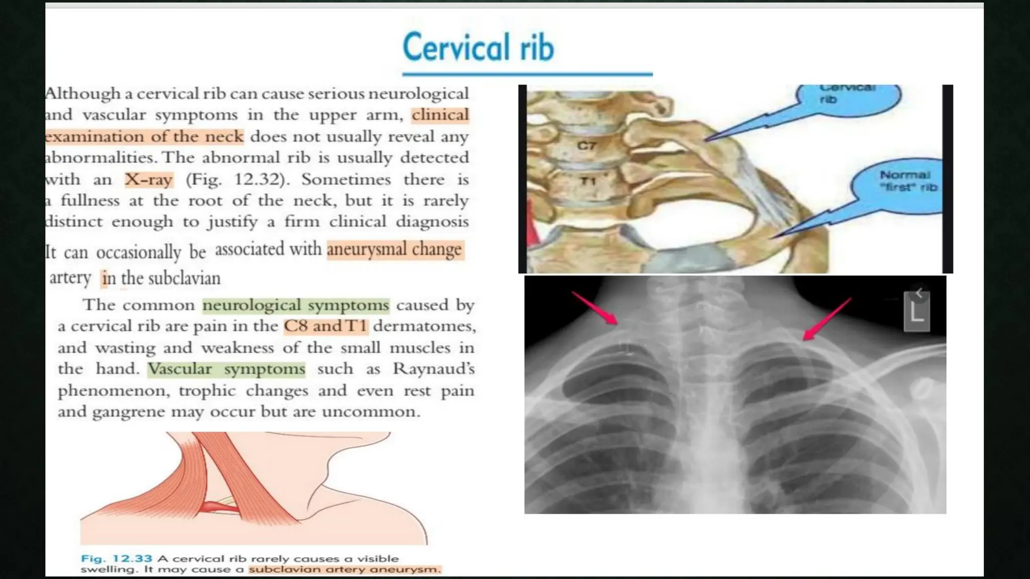 Neck Slides: approach to Neck anatomy and diseases.pdf