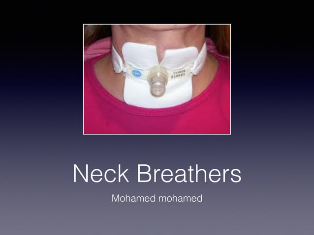 Neck breathers presentation for trainees 2014 | PPT