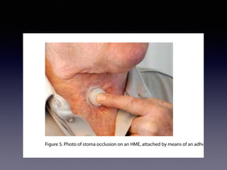 Neck breathers presentation for trainees 2014 | PDF