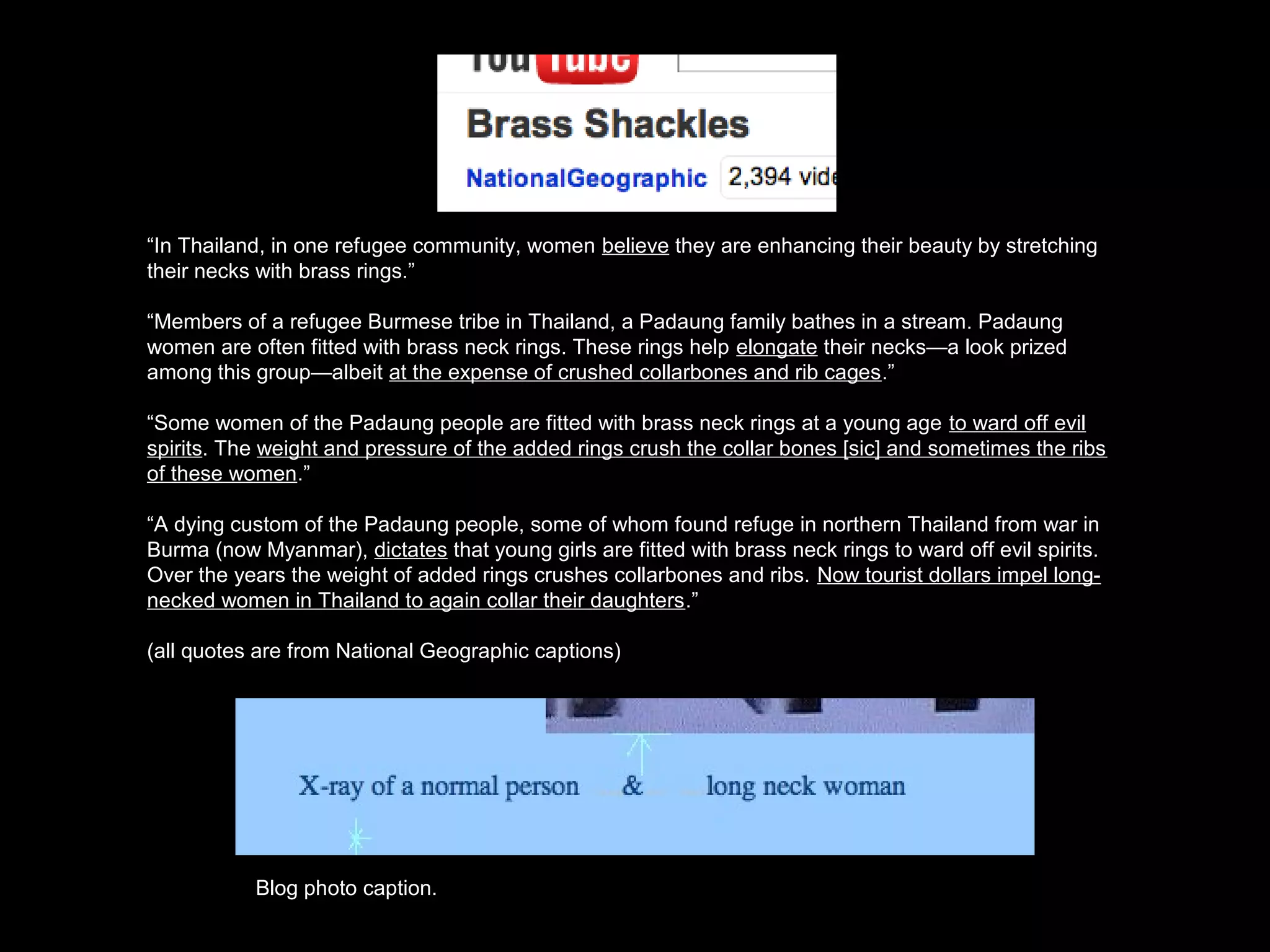 Examining and Contextualizing the Neck Coils of the Padaung Women | PPT