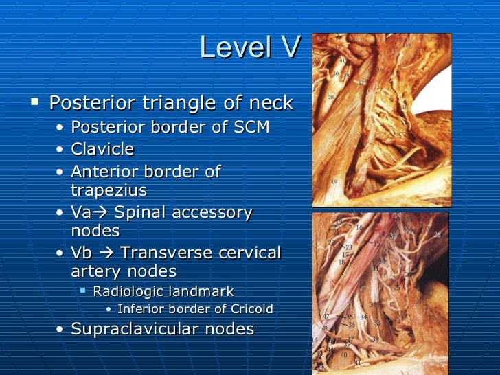 Neck dissection