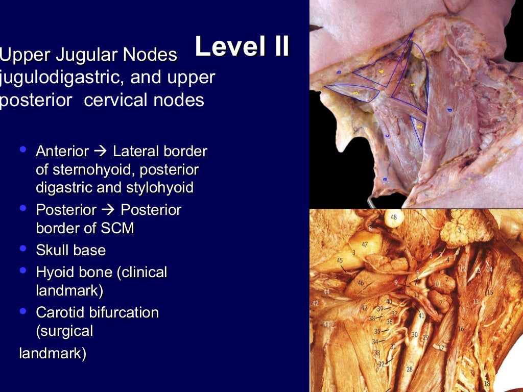 Neck Dissection.Overview
