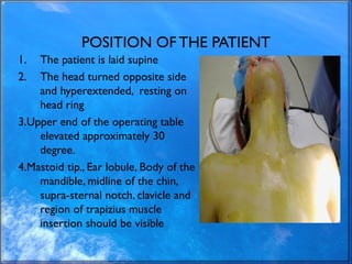 Radical Neck Dissection Post Op