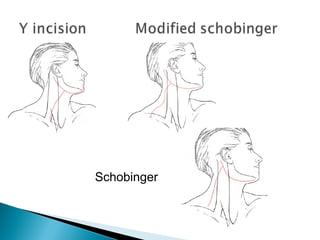 Neck dissection | PPT