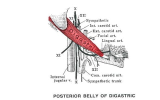 Neck Dissection Dissections Classification Comprehensive Fig Sketch ...