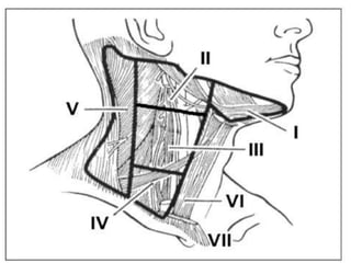 Neck dissection | PPTX