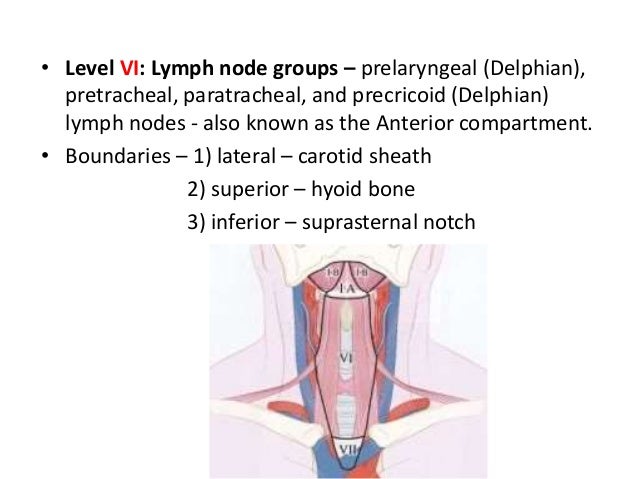 Neck dissection