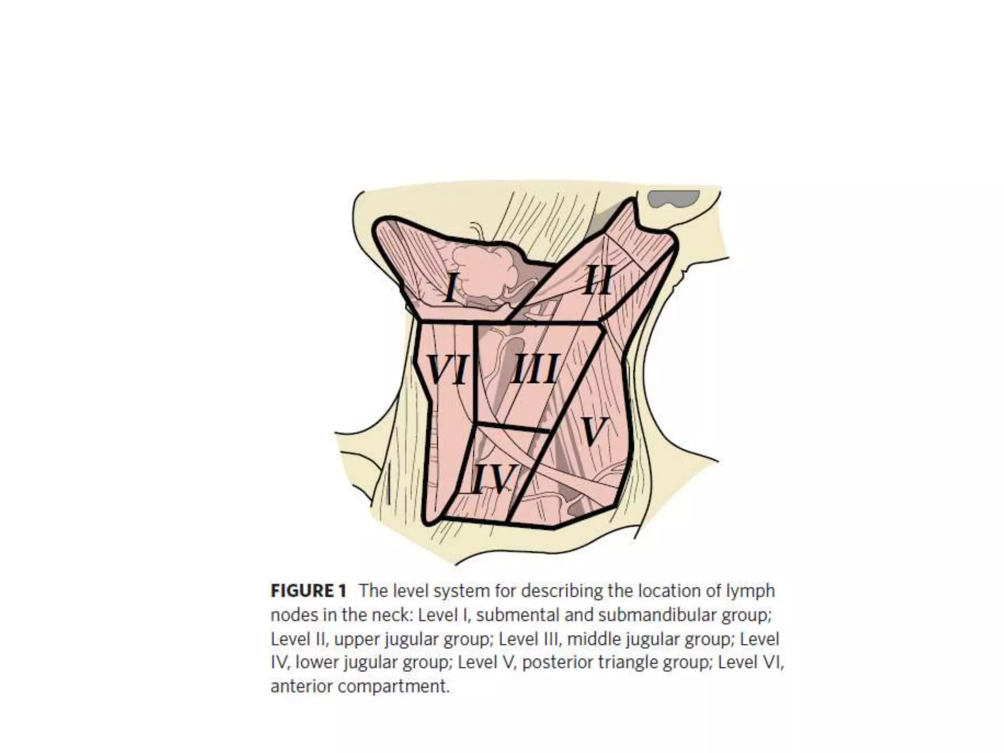 Neck dissection | PPTX