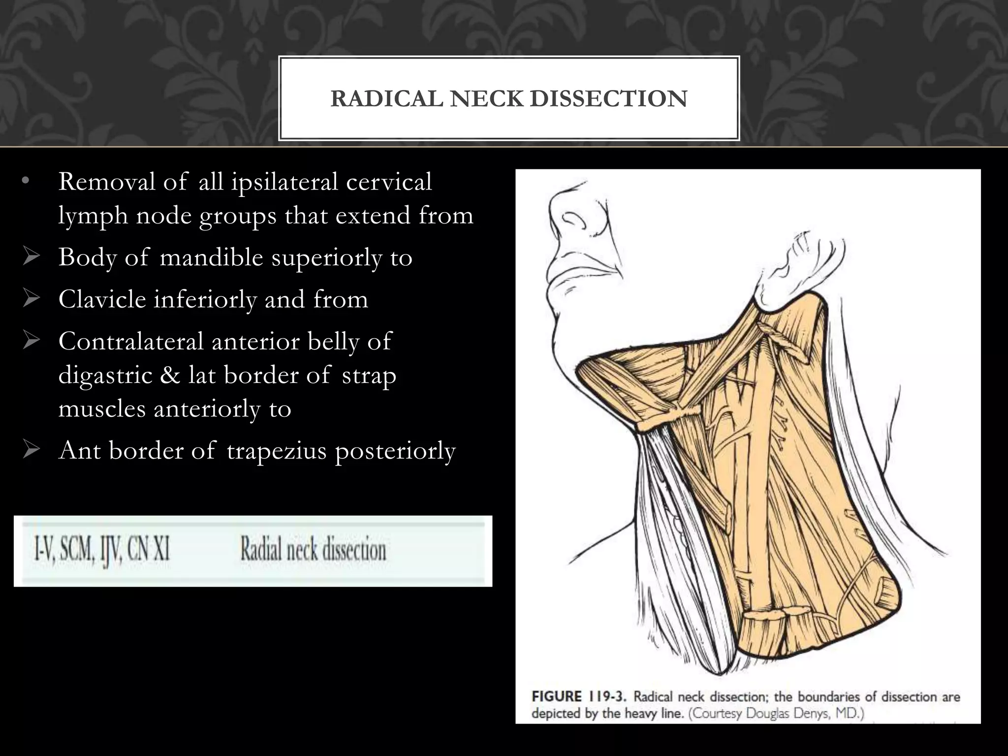 Neck dissection | PPTX