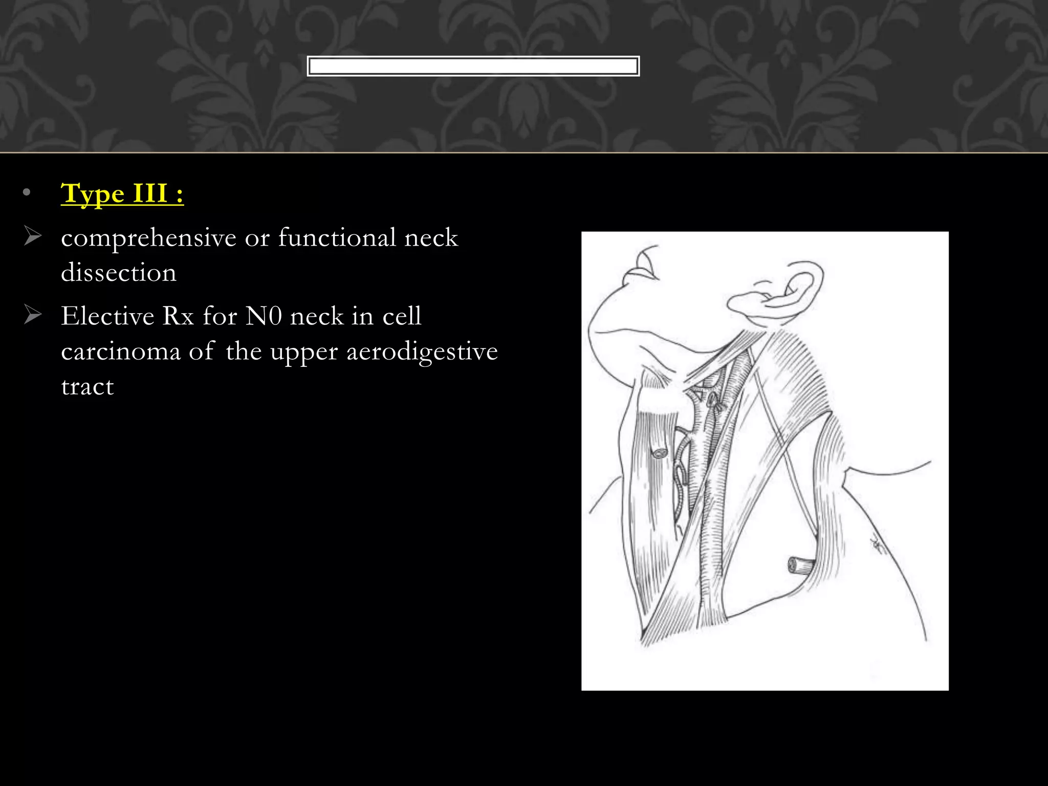 Neck dissection | PPTX