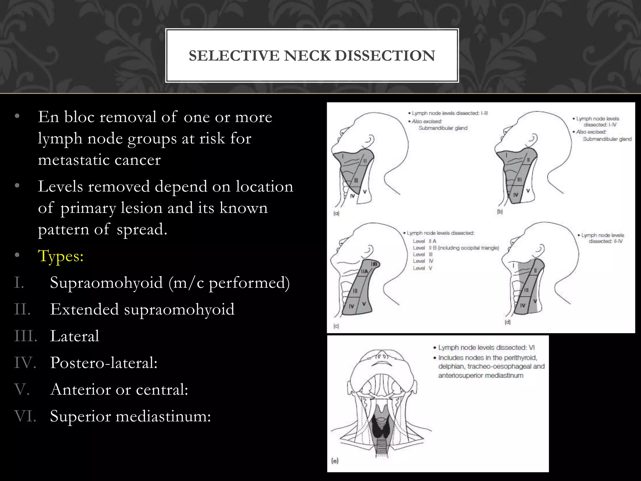 Neck dissection | PPTX