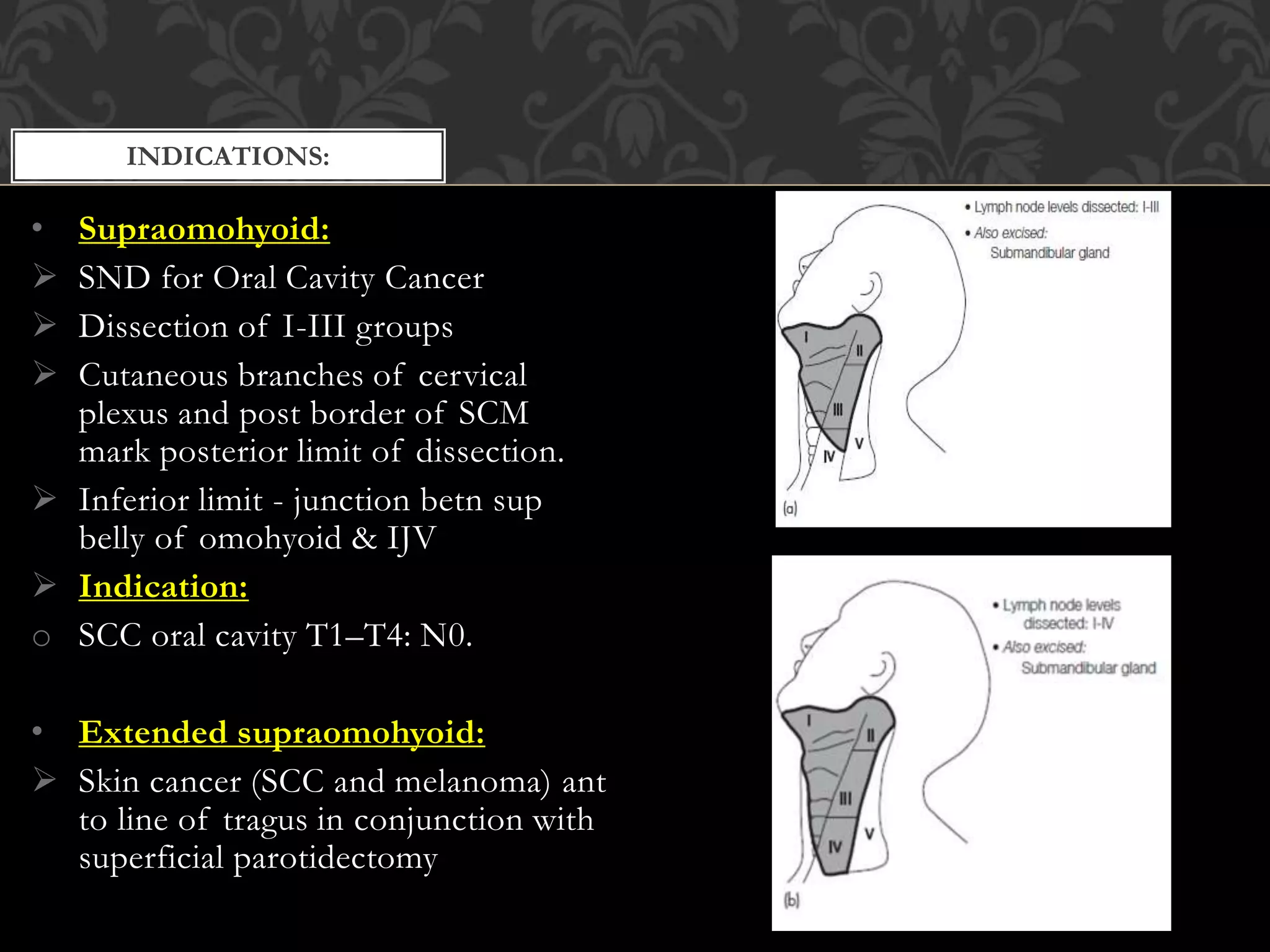 Neck dissection | PPTX