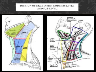 Neck dissection | PPT