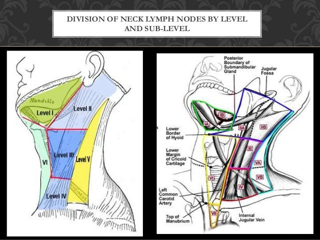 Neck dissection