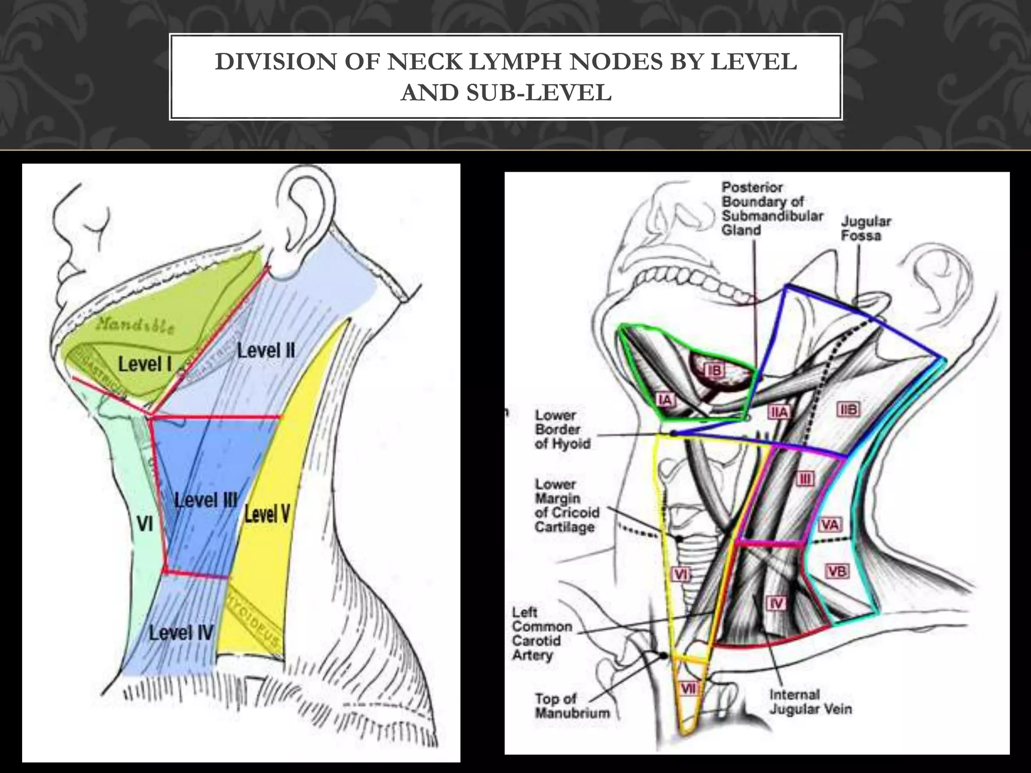 Neck dissection | PPTX