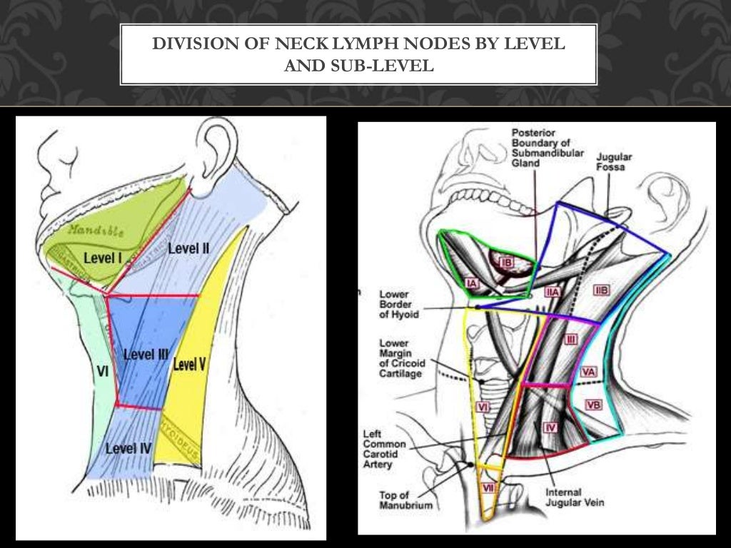 Neck dissection