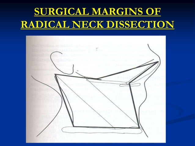 Neck dissection | PPT | Death, Injury, or Military Conflict | Sensitive ...