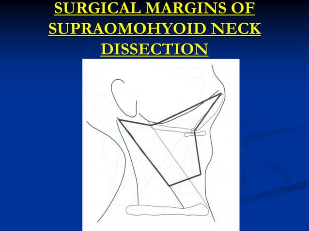 Neck dissection | PPT | Death, Injury, or Military Conflict | Sensitive ...