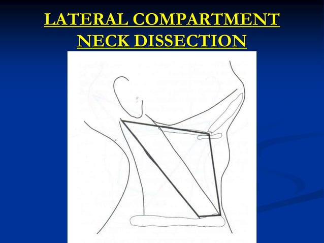 Neck dissection | PPT | Death, Injury, or Military Conflict | Sensitive ...