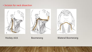 Neck dissection | PPTX