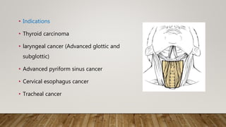 Neck dissection | PPTX