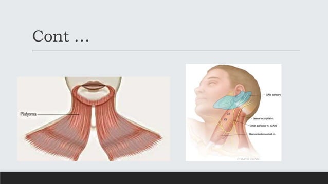 Neck dissection | PPTX