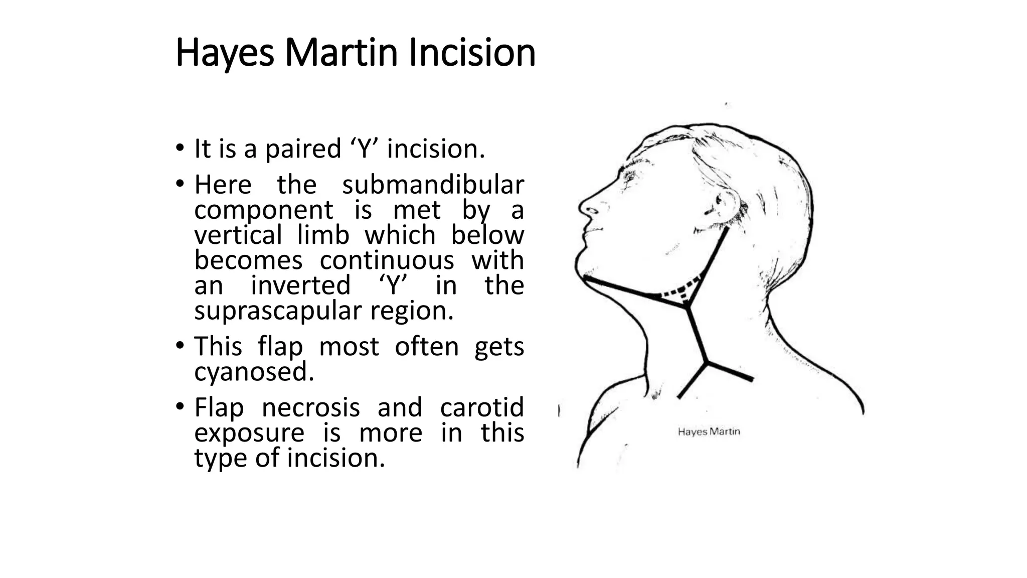 Neck Dissection.pptx