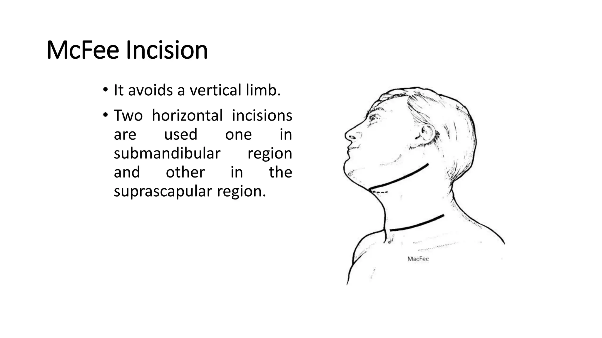 Neck Dissection.pptx