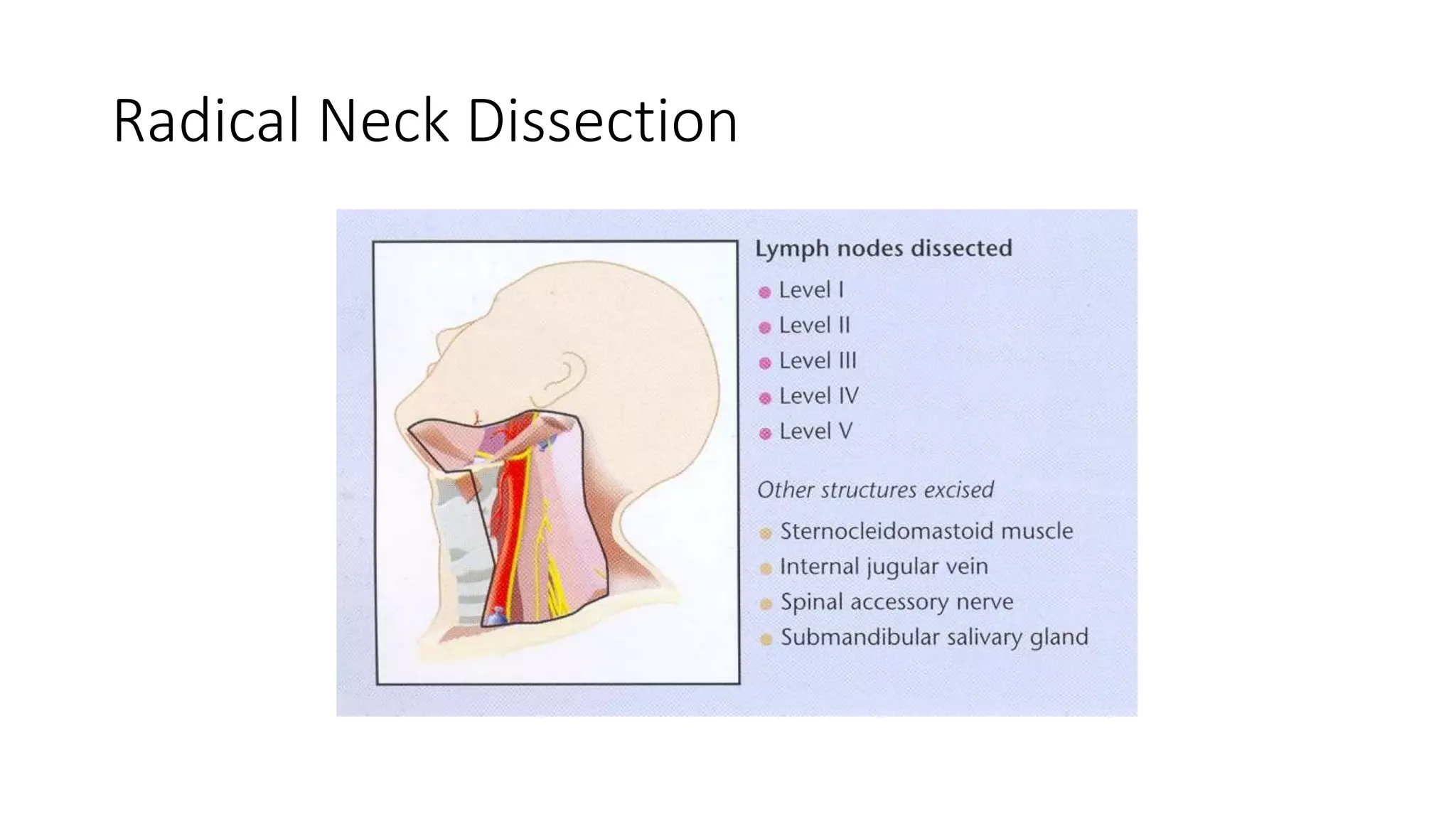 Neck Dissection.pptx