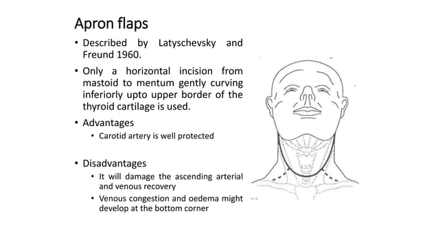 Neck Dissection.pptx