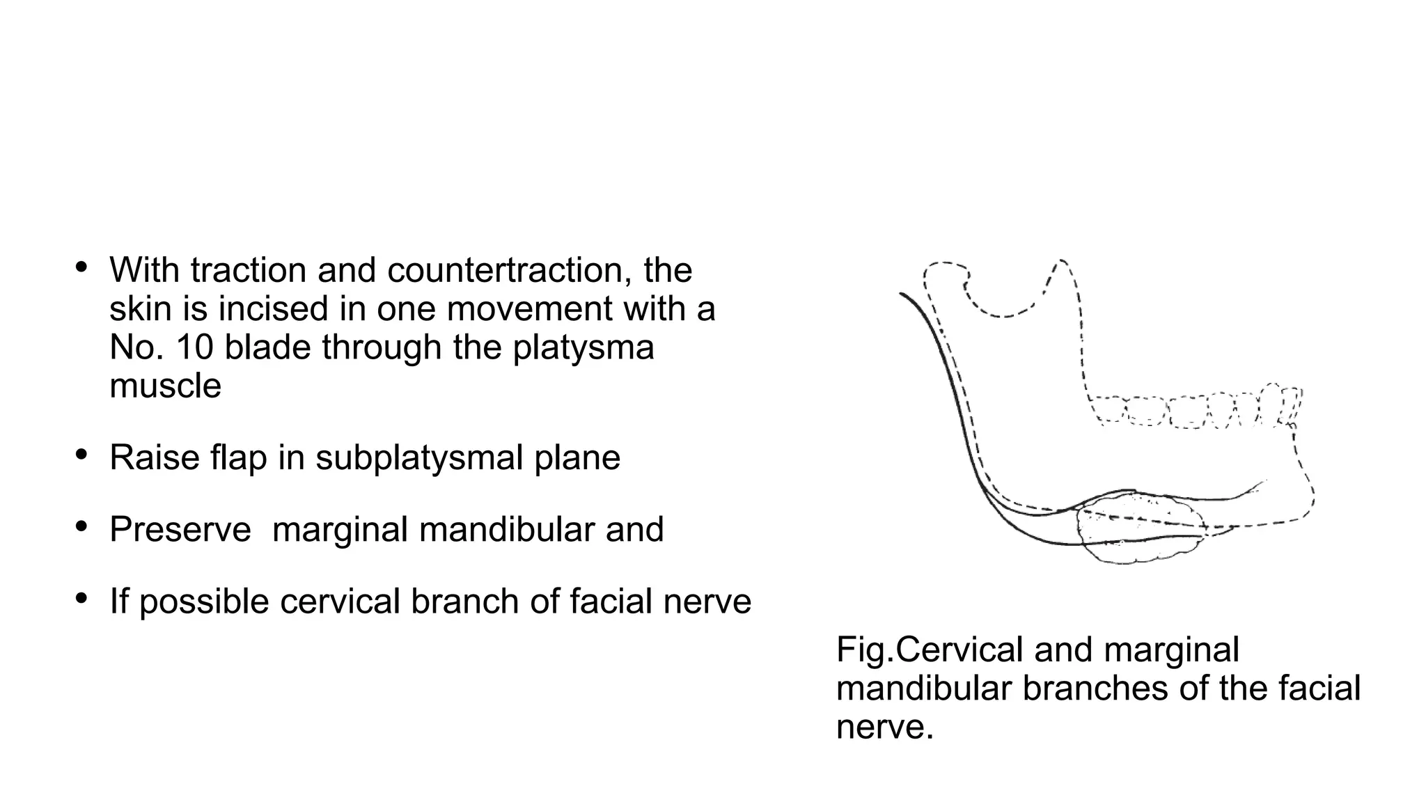 Neck Dissection Head Neck oncoSurgery.pptx