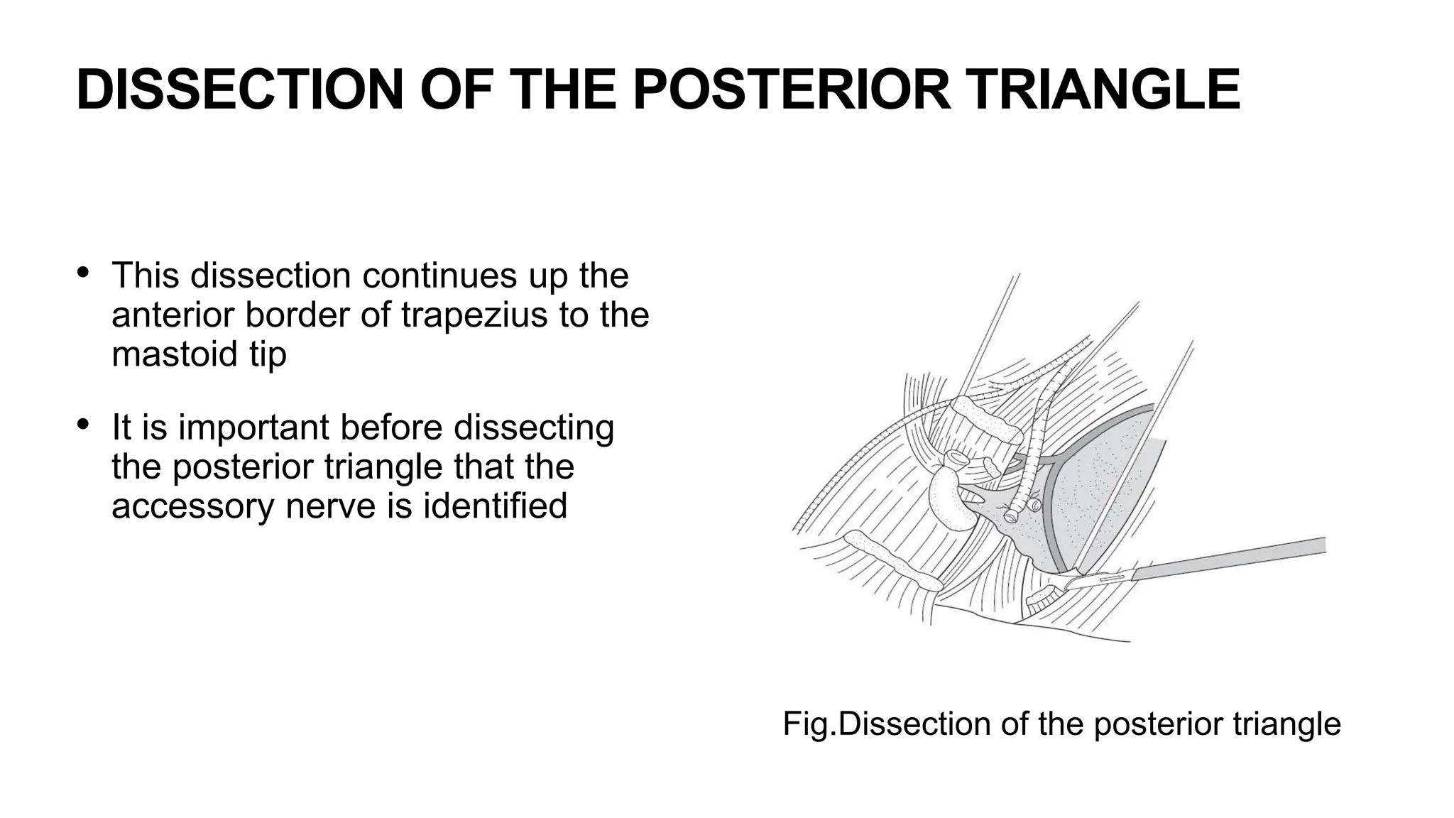 Neck Dissection Head Neck oncoSurgery.pptx