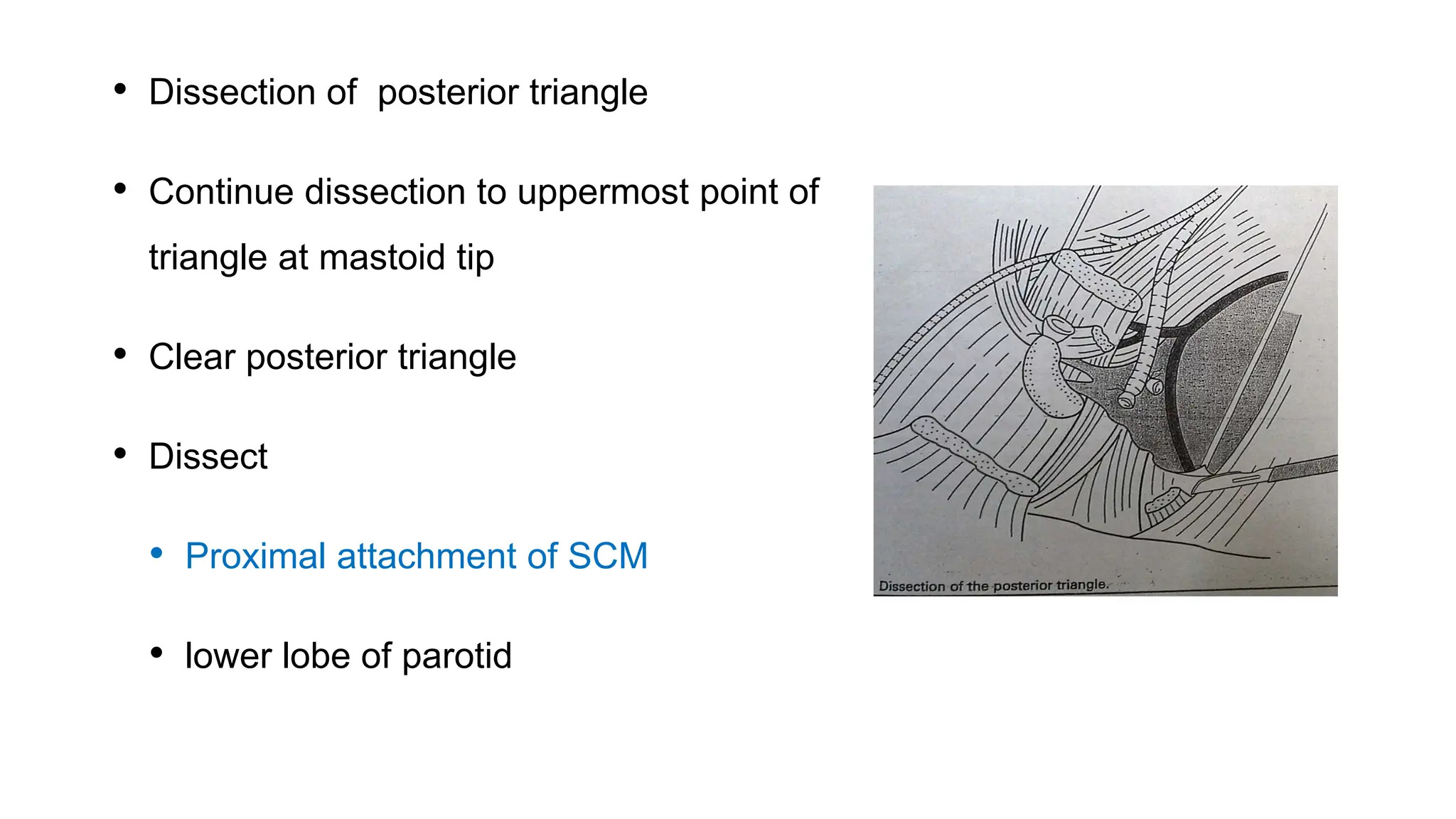Neck Dissection Head Neck oncoSurgery.pptx