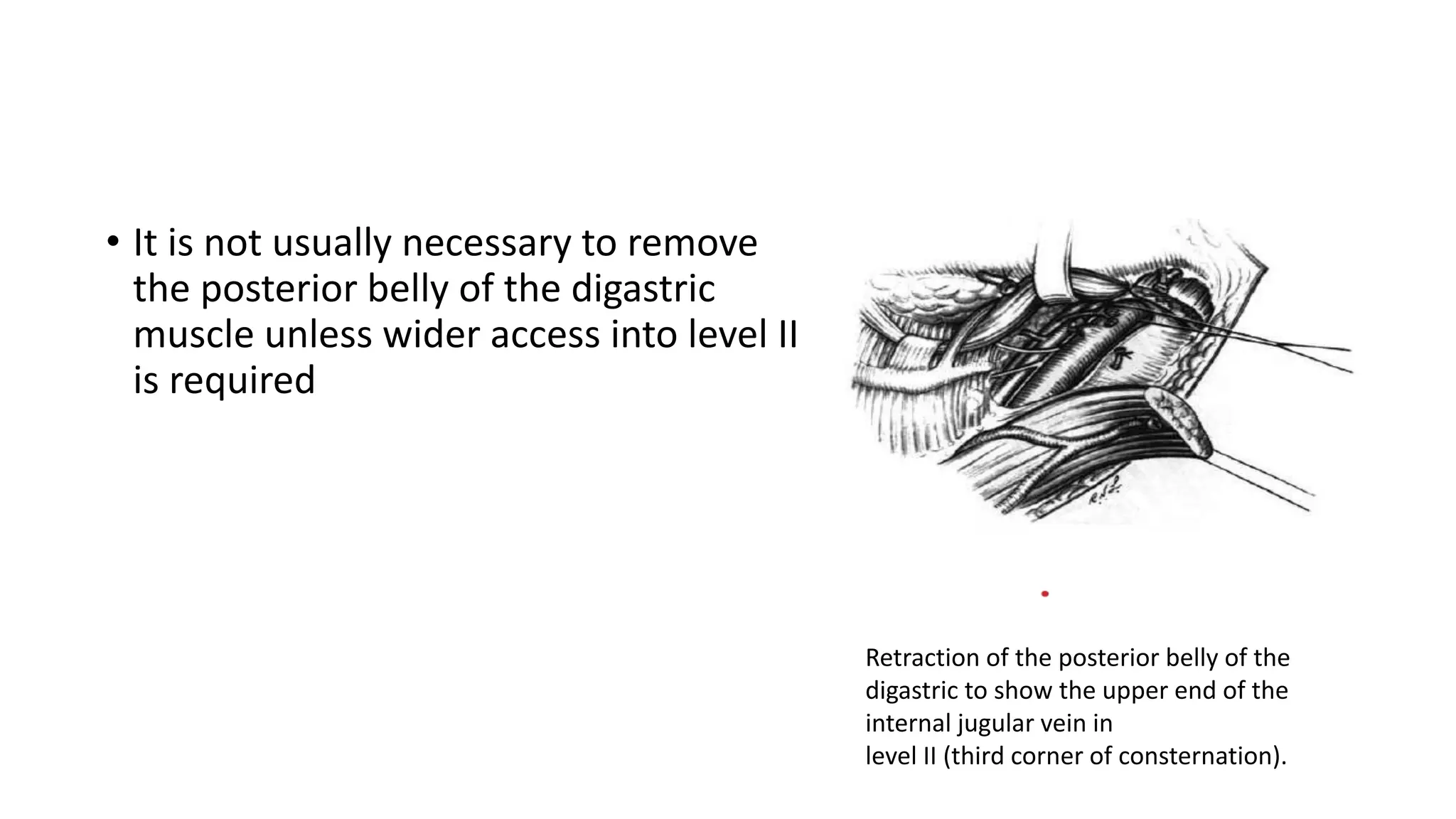 Neck Dissection Head Neck oncoSurgery.pptx